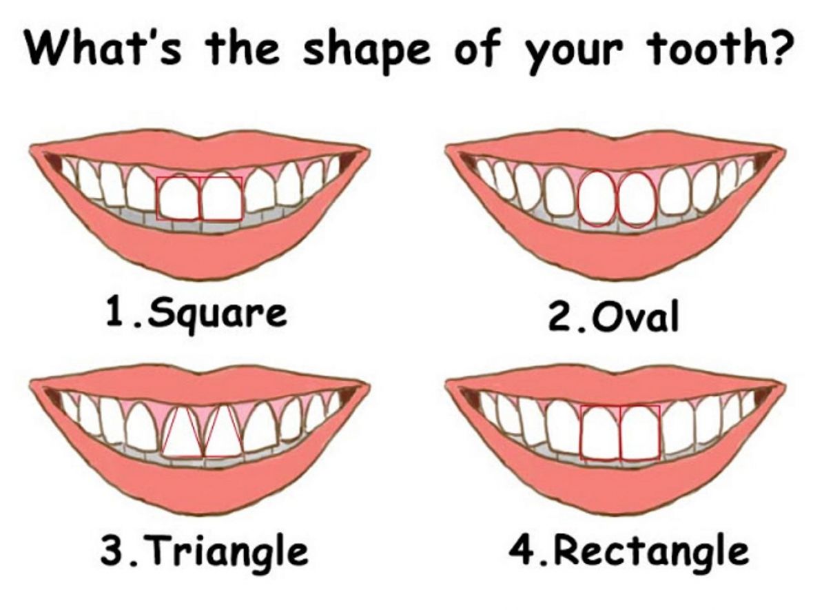 Savjeti /Šta oblik vaših zuba otkriva o vama / Radio Sarajevo